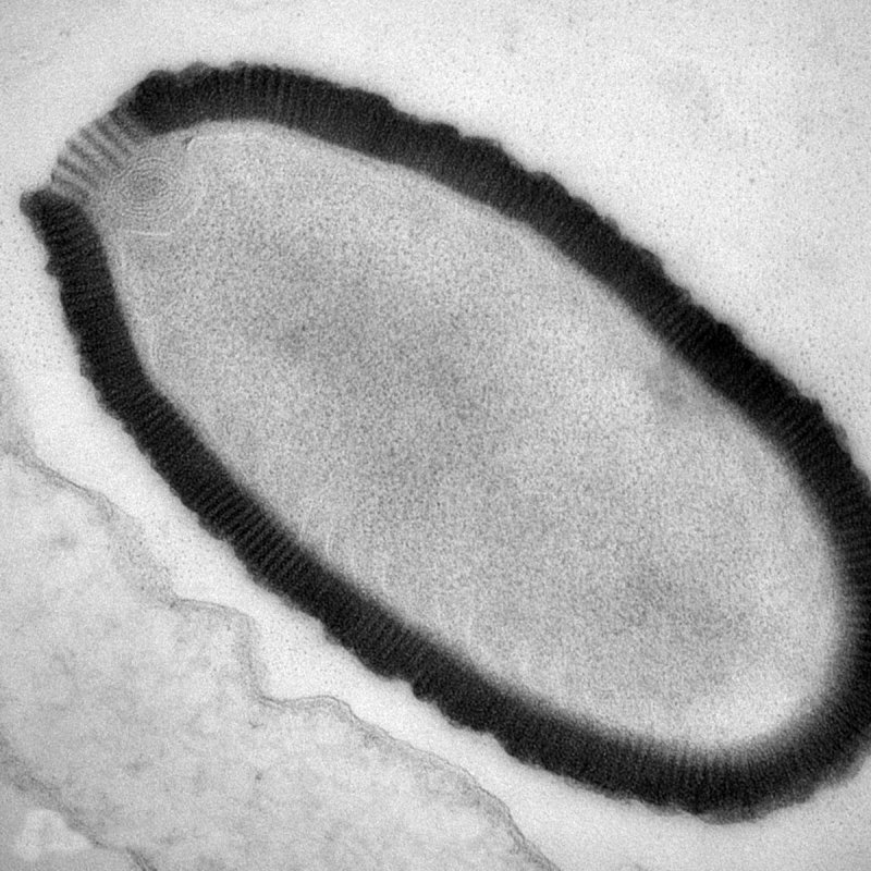 Allarme o no? Risorge un virus gigante di 30 mila anni fa | WSI